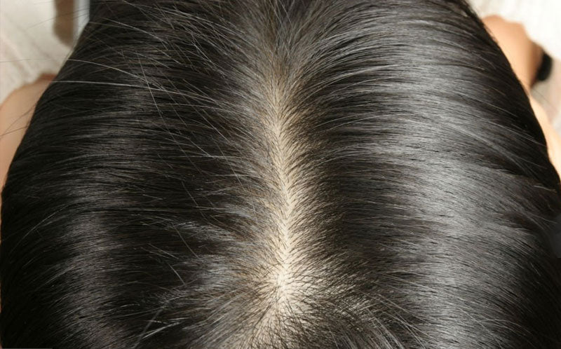 The Truth About Hair Shedding: What's Normal and What's Not – VERSUS™